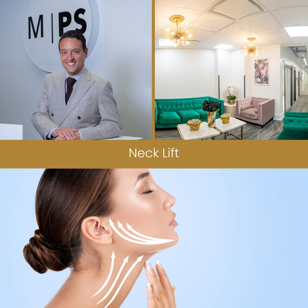 Neck Lift NYC - Neck Tightening Surgery in Manhattan & Bronx