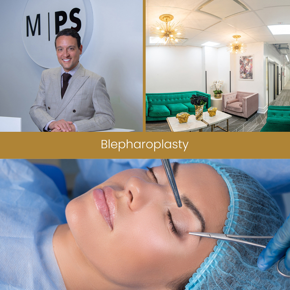 Blepharoplasty NYC – Expert Eyelid Surgeon in Manhattan & Bronx