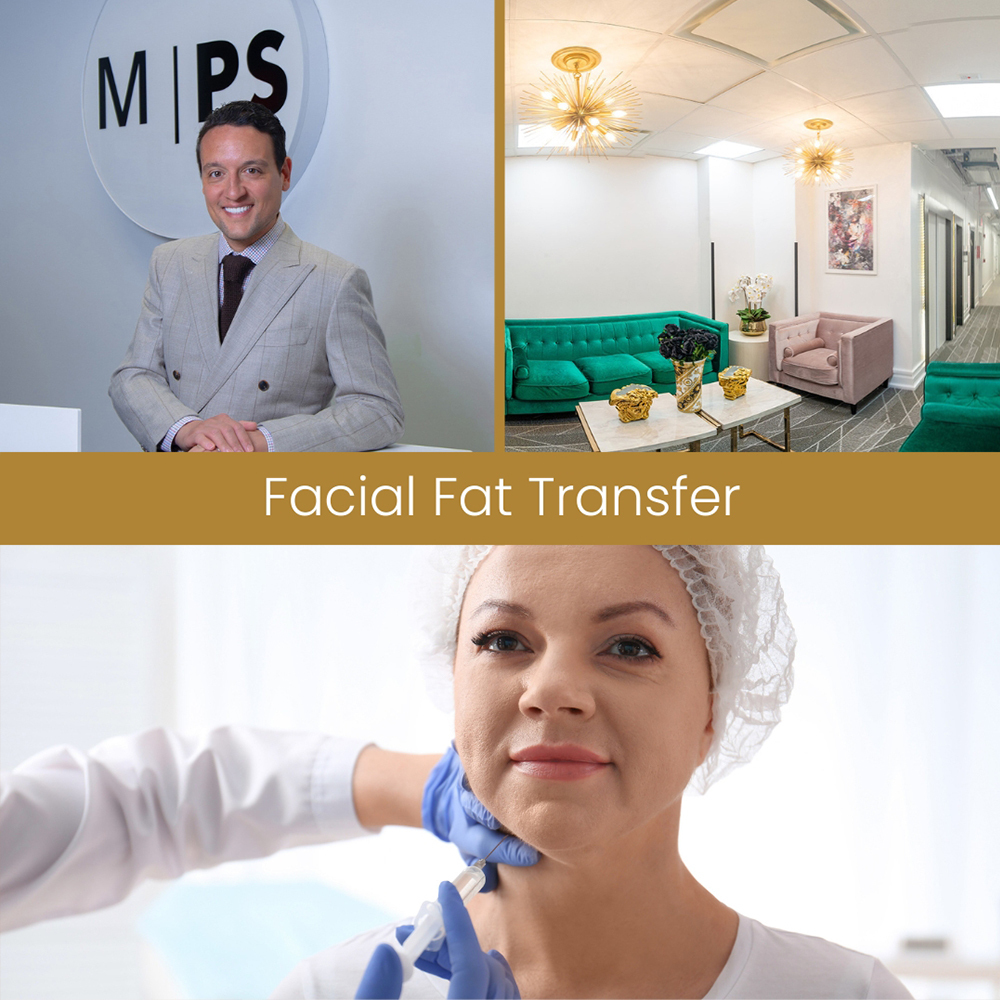 Fat Transfer to Face NYC - Fat Grafting Surgeon Manhattan & Bronx