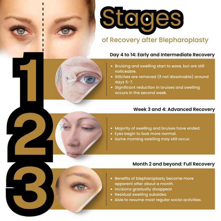 Blepharoplasty Recovery Timeline | Eyelid Surgery Recovery